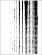 lexmark laser printer streaks